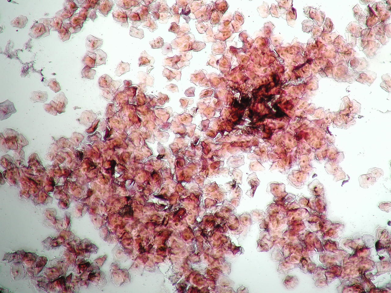 Canine Reproduction : Vaginal Smears and Timing of Ovulation – DR ...