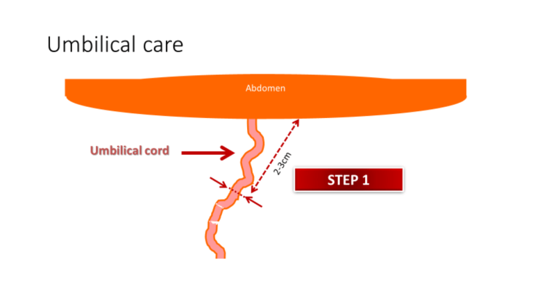 When do Kitten Umbilical Cords Fall Off? Clever Insights – DR. EMMANUEL ...